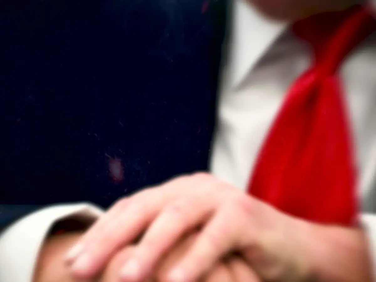 Trump Seen With Bruised Right Hand Again | ‘IV Wounds Hidden With Makeup’?