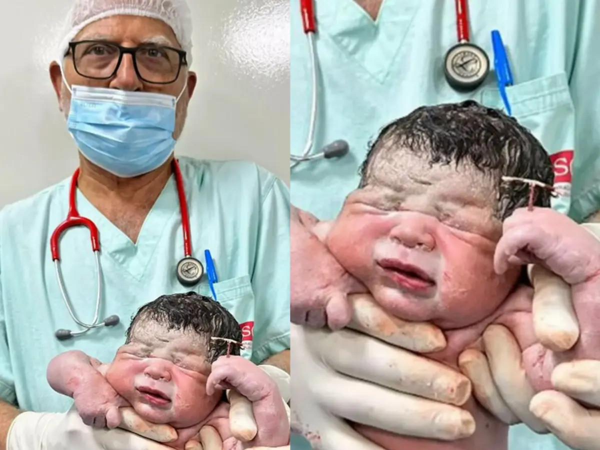 Rarest of rare case: Brazil baby born with contraceptive clenched in fist