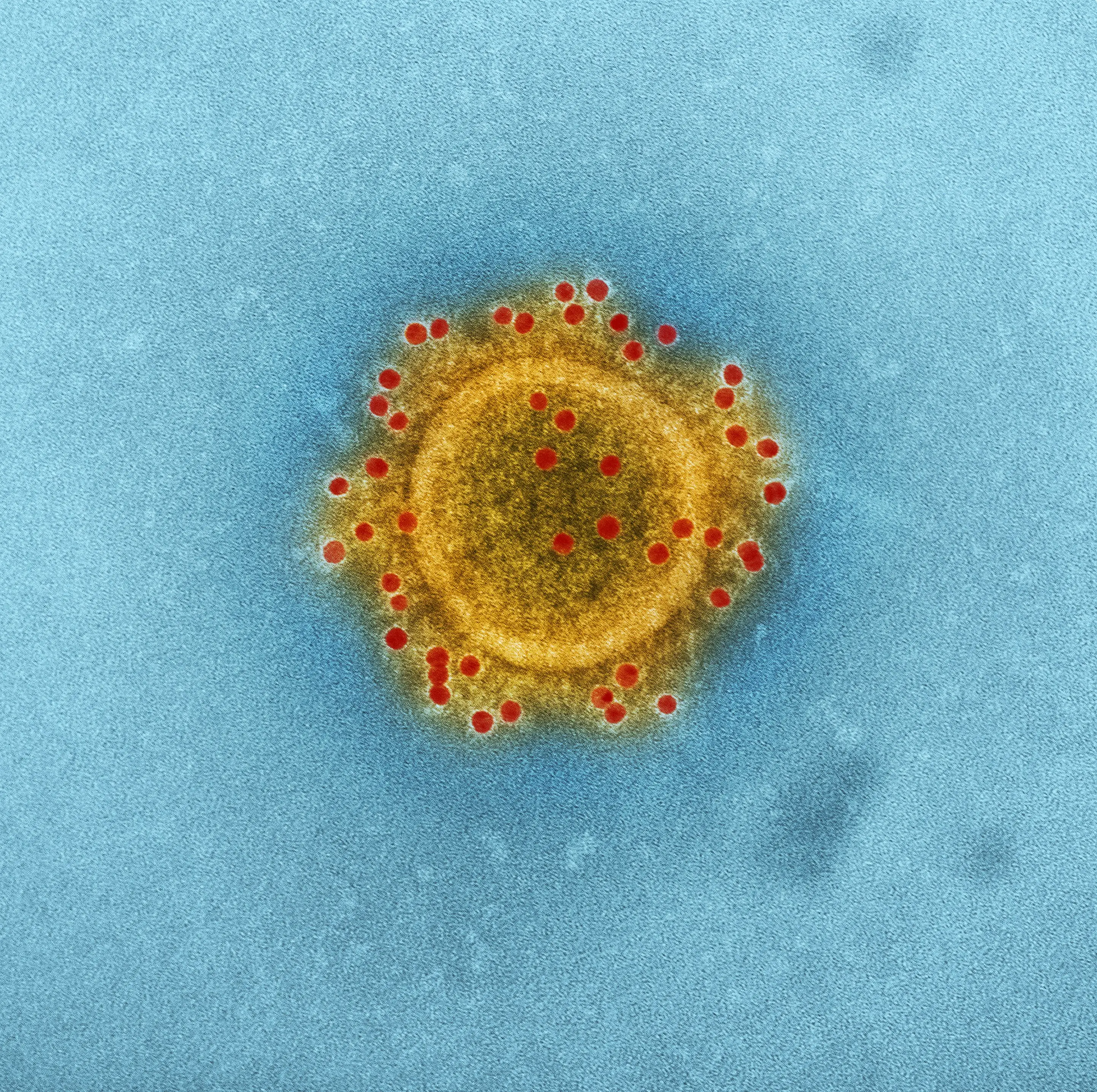 Kerala’s ‘brain-eating amoeba’ scare deepens: 3-year-old latest to be ...