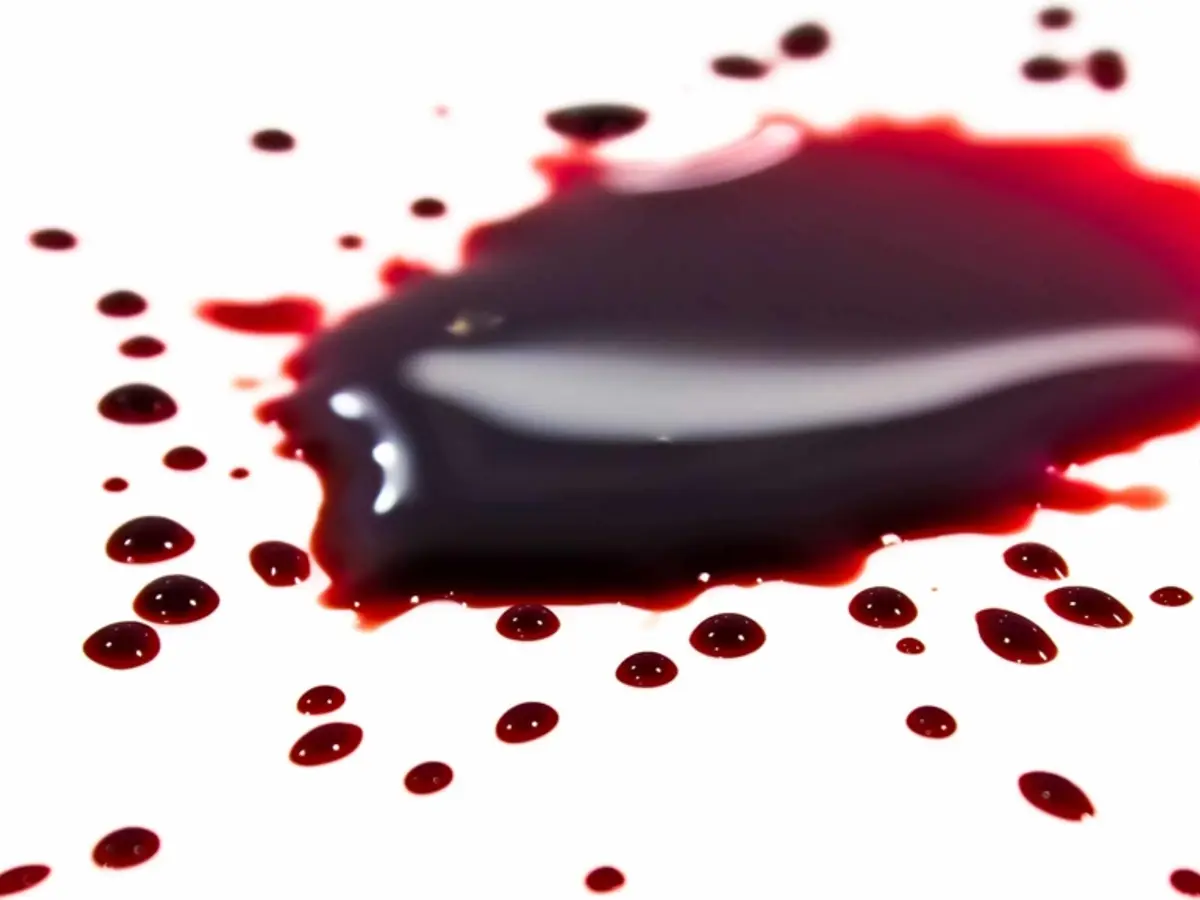 Scientists discover world's rarest blood group found only in 3 people