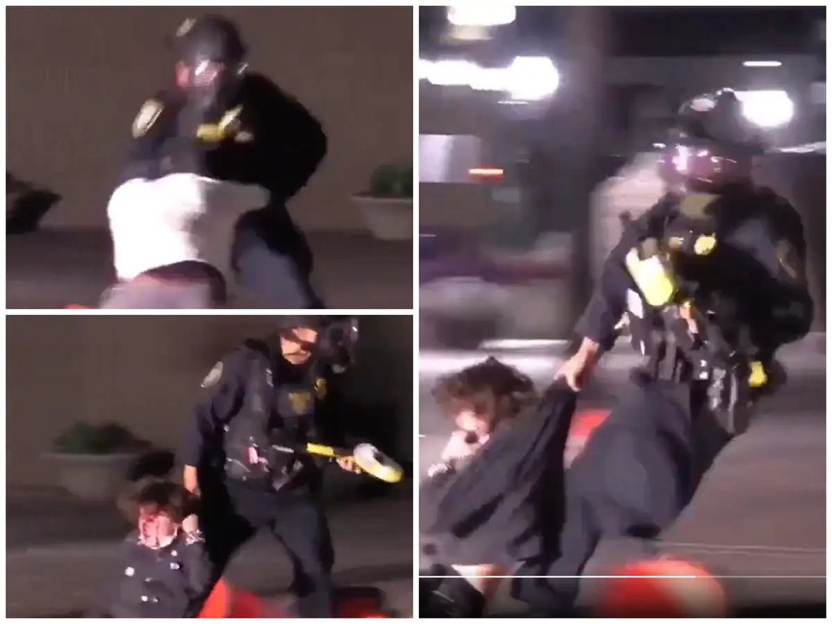 Anti-ICE protestor shot at, dragged, left blind after 6-hour surgery in ...