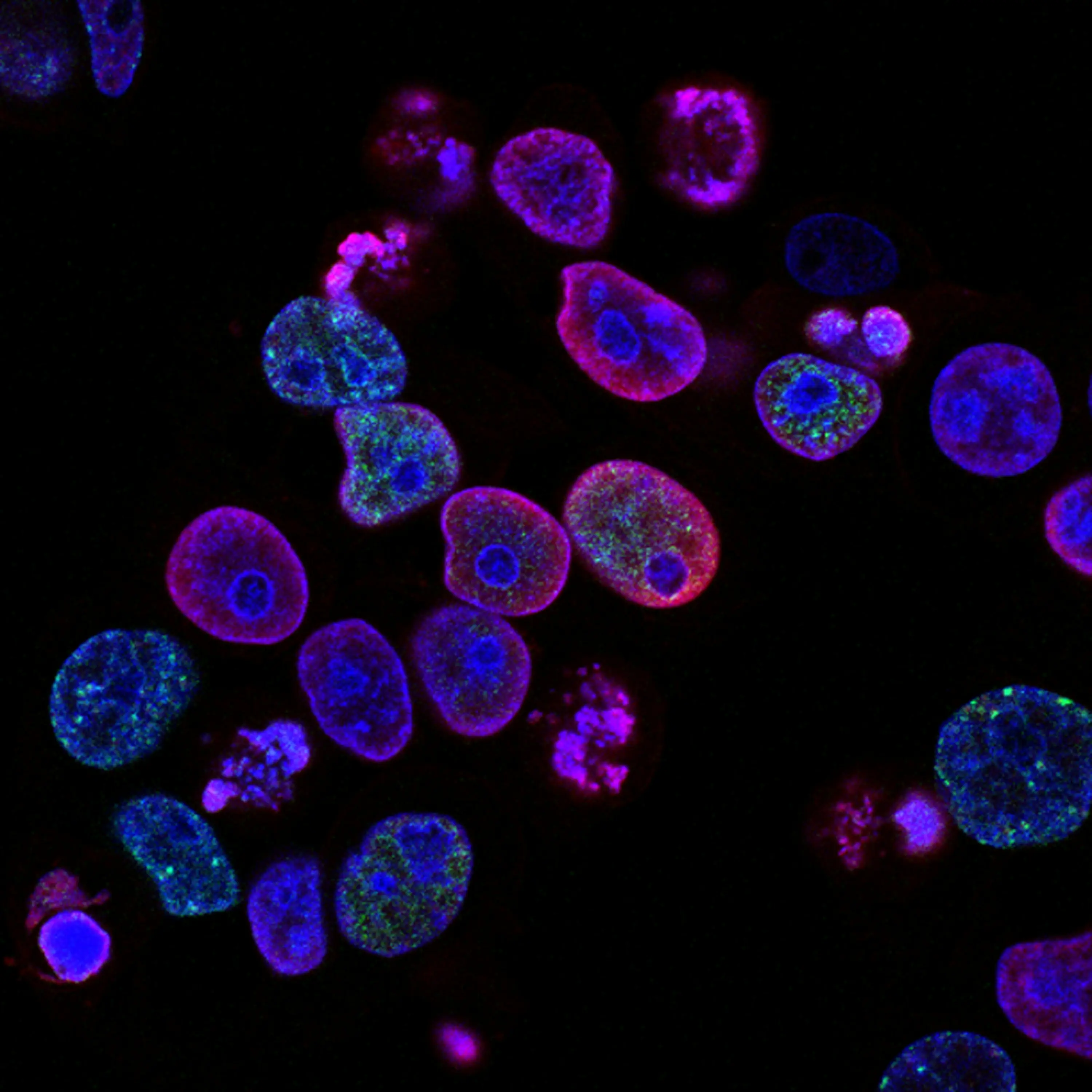 World Cancer Day 2026: Top 10 countries with highest cancer rates
